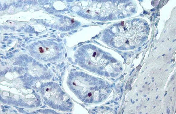 Histone H3S10ph (phospho Ser10)抗体 (GTX128116) | GeneTex中国官方网站