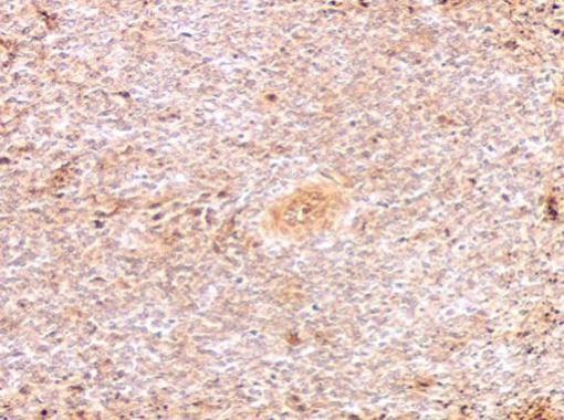 Porcine circovirus type 2 / PCV2 Capsid抗体 (GTX128121) | GeneTex中国官方网站