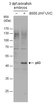 p53抗体 (GTX128135) | GeneTex中国官方网站