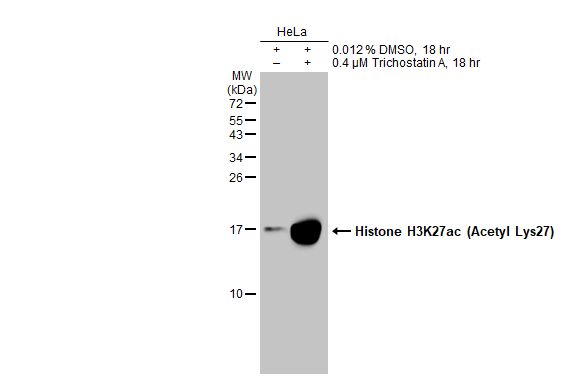 Histone H3K27ac (Acetyl Lys27)抗体 (GTX128944) | GeneTex中国官方网站