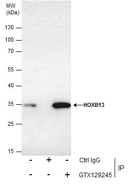 HOXB13抗体 (GTX129245) | GeneTex中国官方网站