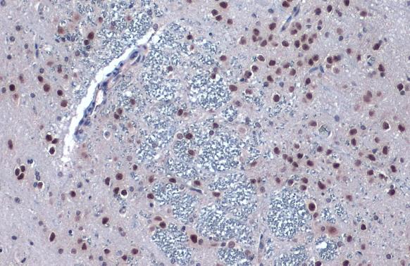 PERK抗体 (GTX129275) | GeneTex中国官方网站