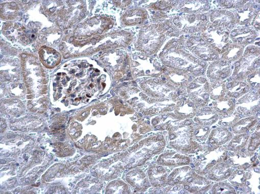 MAFB抗体 (GTX129437) | GeneTex中国官方网站