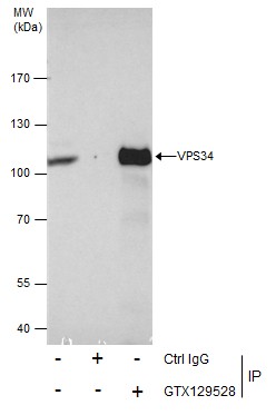 VPS34 antibody价格,详情介绍-960化工网 – 960化工网