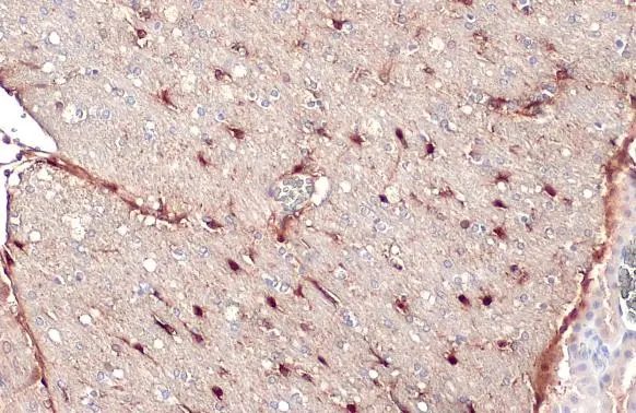 S100 beta抗体 (GTX129573) | GeneTex中国官方网站