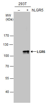 LGR5抗体 (GTX129597) | GeneTex中国官方网站