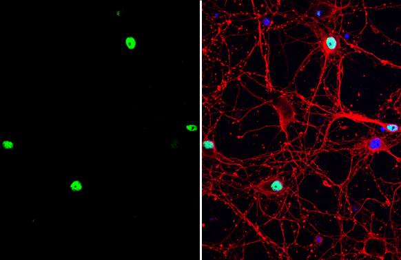 c-Fos抗体 (GTX129846) | GeneTex中国官方网站
