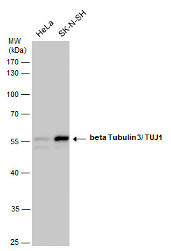 beta Tubulin 3/ Tuj1抗体 (GTX129913) | GeneTex中国官方网站
