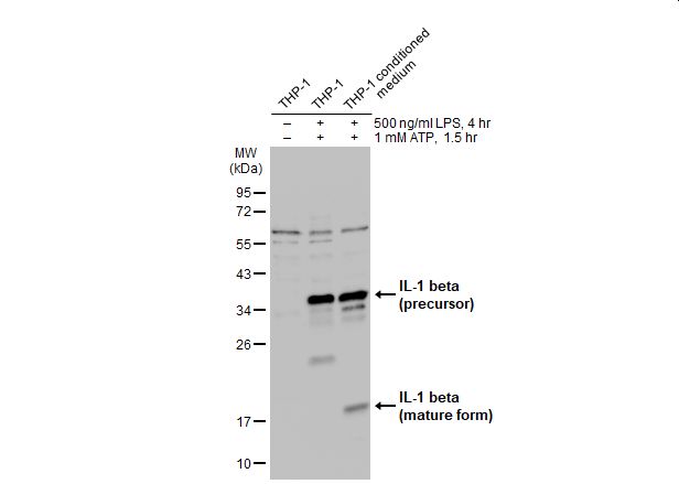 IL1 beta抗体 (GTX130021) | GeneTex中国官方网站