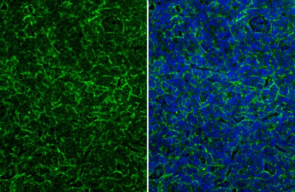 CD90抗体 (GTX130072) | GeneTex中国官方网站