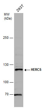 HERC5抗体 (GTX130167) | GeneTex中国官方网站
