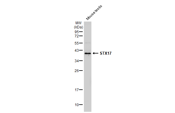 STX17抗体 (GTX130212) | GeneTex中国官方网站