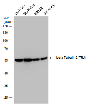 beta Tubulin 3/ Tuj1抗体 (GTX130245) | GeneTex中国官方网站