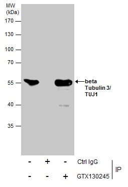beta Tubulin 3/ Tuj1抗体 (GTX130245) | GeneTex中国官方网站