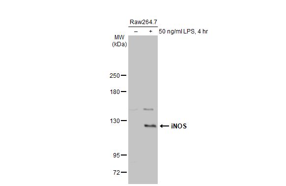 iNOS抗体 (GTX130246) | GeneTex中国官方网站