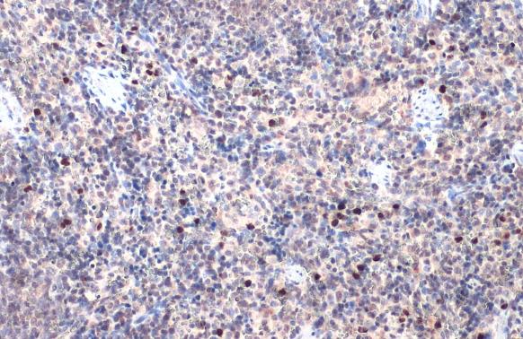 iNOS抗体 (GTX130246) | GeneTex中国官方网站