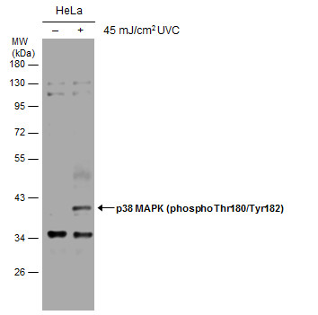 p38 MAPK (phospho Thr180/Tyr182)抗体 (GTX130383) | GeneTex中国官方网站
