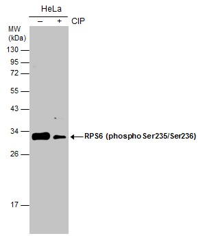 RPS6 (phospho Ser235/236)抗体 (GTX130430) | GeneTex中国官方网站
