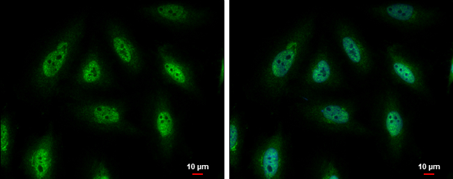 PYK2抗体 (GTX130887) | GeneTex中国官方网站
