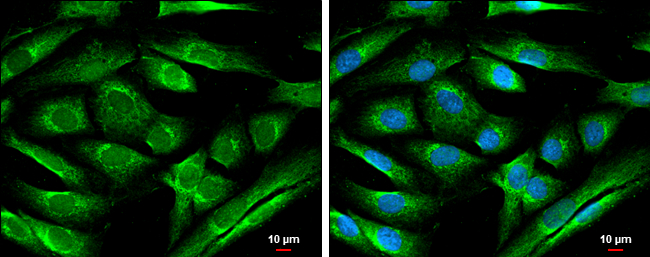 ATL1抗体 (GTX131075) | GeneTex中国官方网站
