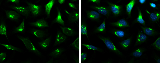B4GALT1抗体 (GTX131598) | GeneTex中国官方网站