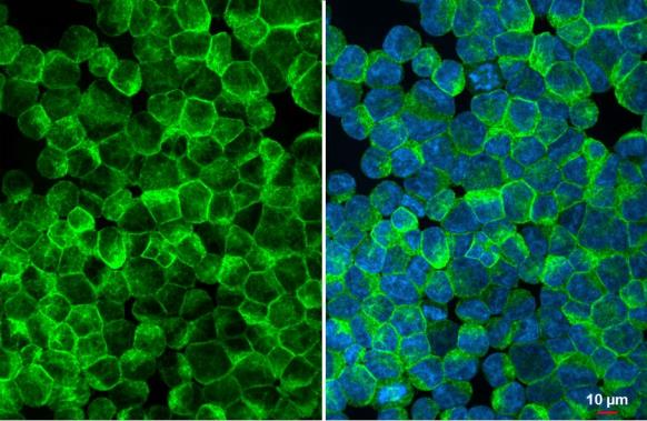 CD169抗体 (GTX131703) | GeneTex中国官方网站