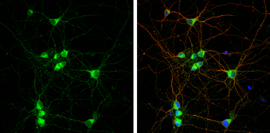 RAB7A抗体 (GTX132548) | GeneTex中国官方网站