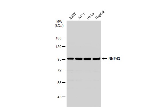 RNF43抗体 (GTX132671) | GeneTex中国官方网站