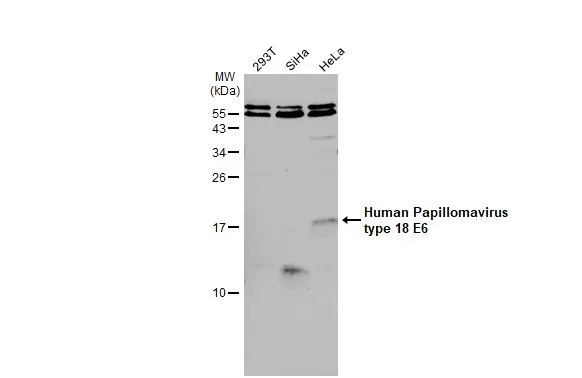 Human Papillomavirus type 18 E6抗体 (GTX132687) | GeneTex中文官方网站
