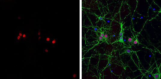 NeuN抗体 (GTX132974) | GeneTex中国官方网站