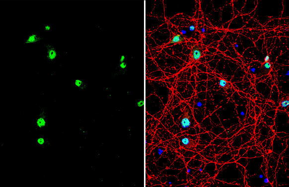 NeuN抗体 (GTX132974) | GeneTex中国官方网站