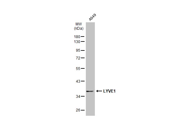 LYVE1抗体 (GTX133081) | GeneTex中国官方网站