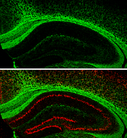 Myelin basic Protein抗体 (GTX133108) | GeneTex中国官方网站