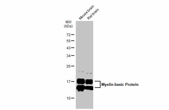 Myelin basic Protein抗体 (GTX133108) | GeneTex中国官方网站