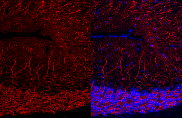 MAP2抗体 (GTX133109) | GeneTex中国官方网站