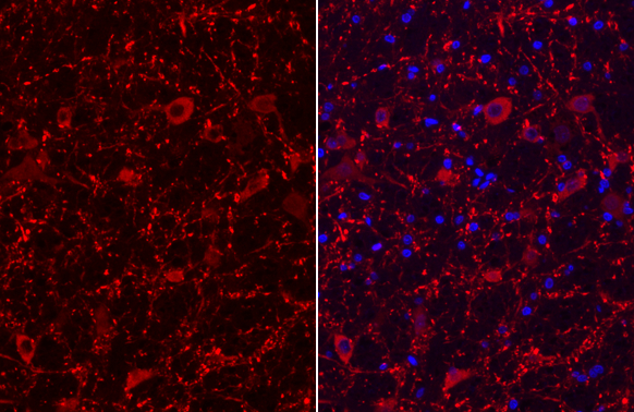 MAP2抗体 (GTX133109) | GeneTex中国官方网站