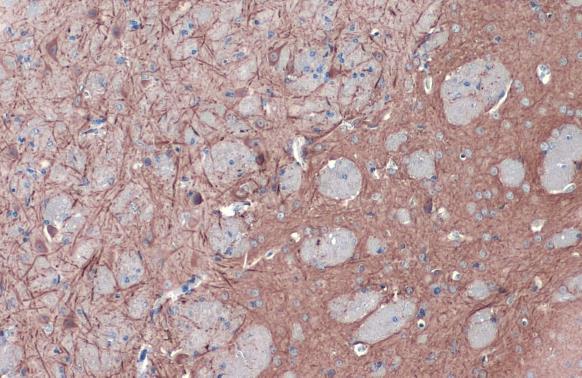 MAP2抗体 (GTX133109) | GeneTex中国官方网站