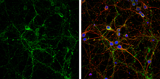 VGLUT2抗体 (GTX133142) | GeneTex中国官方网站