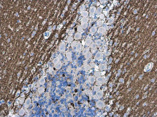 VGluT1抗体 (GTX133148) | GeneTex中国官方网站