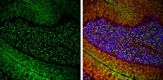 VGluT1抗体 (GTX133148) | GeneTex中国官方网站