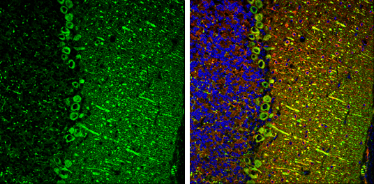 IP3 Receptor I抗体 (GTX133149) | GeneTex中国官方网站