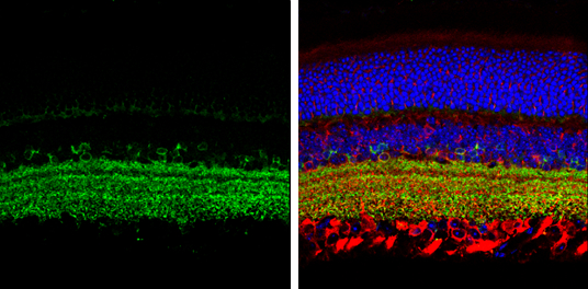 GAD65抗体 (GTX133156) | GeneTex中国官方网站