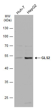 GLS2抗体 (GTX133243) | GeneTex中国官方网站
