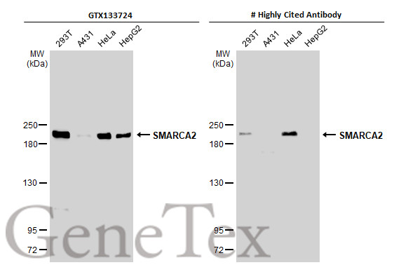 SMARCA2抗体 (GTX133724) | GeneTex中国官方网站