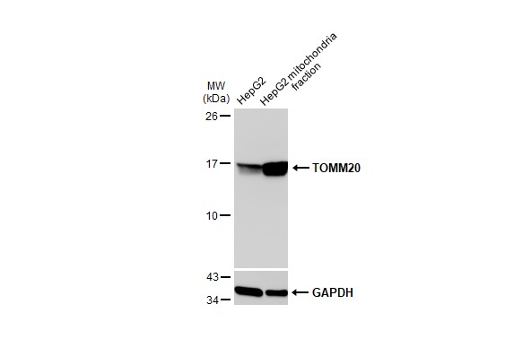 TOMM20抗体 (GTX133756) | GeneTex中国官方网站