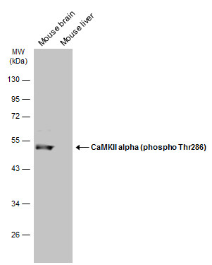 CaMKII alpha (phospho Thr286)抗体 (GTX133859) | GeneTex中国官方网站