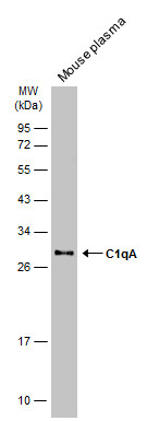 C1qA抗体 (GTX134007) | GeneTex中国官方网站