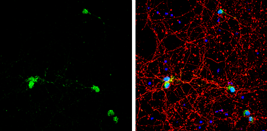 HuC抗体 (GTX134128) | GeneTex中国官方网站