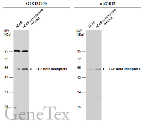 TGF beta Receptor I抗体 (GTX134209) | GeneTex中国官方网站