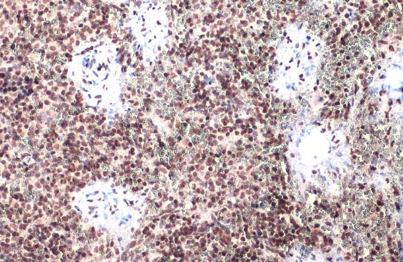 IRF3 (phospho Ser396)抗体 (GTX134360) | GeneTex中国官方网站